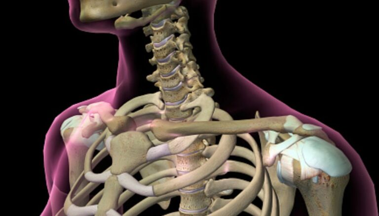 Understanding Cervical Ribs or Extra Ribs - Punekar News