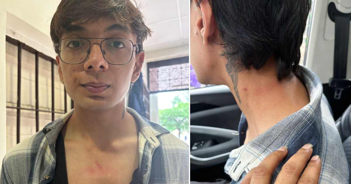 Pune Road Rage: Woman Raises Alarm Over Brutal Attack and Police ...