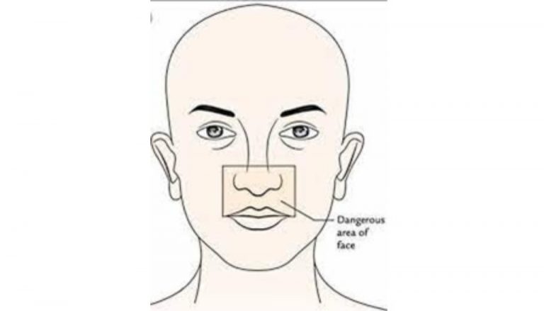 Understanding the Hidden Risks of Acne and the Dangers of the "Triangle ...