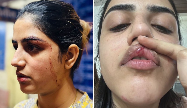 Hagawane Family Scandal Deepens: Mayuri Hagawane Alleges Assault by In ...